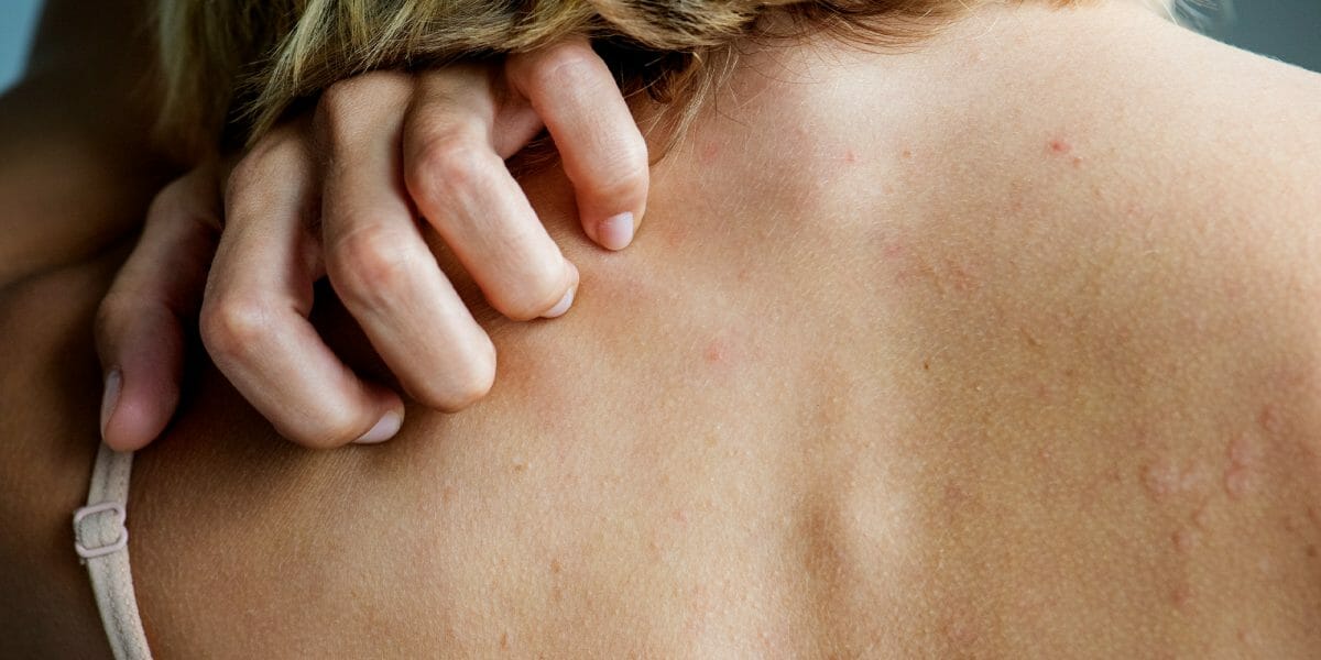 Working out is both good and bad for your skin | Oralift